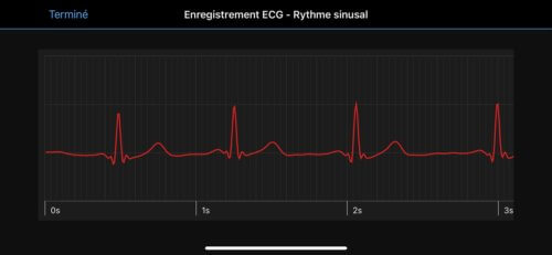 Tout savoir sur l'ECG (électrocardiogramme) des montres Garmin - nakan.ch