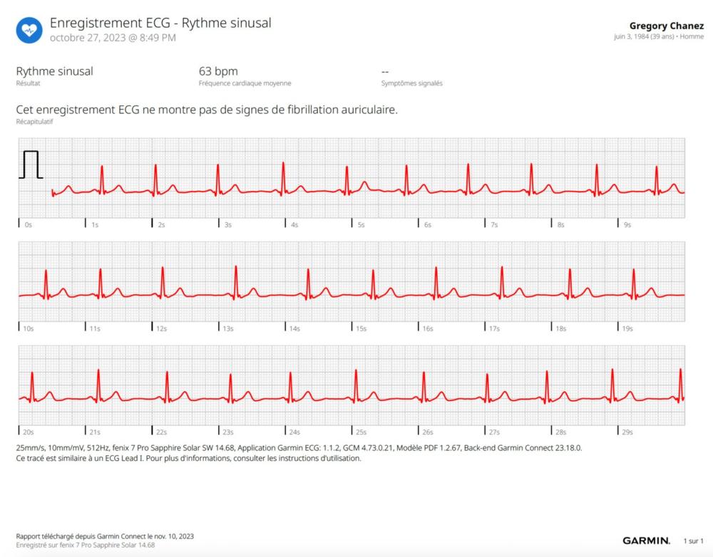Tout savoir sur l'ECG (électrocardiogramme) des montres Garmin - nakan.ch